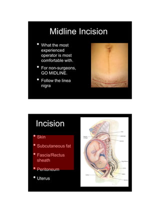 Th 229-post-mortem-c-section-perimortem1 | PDF