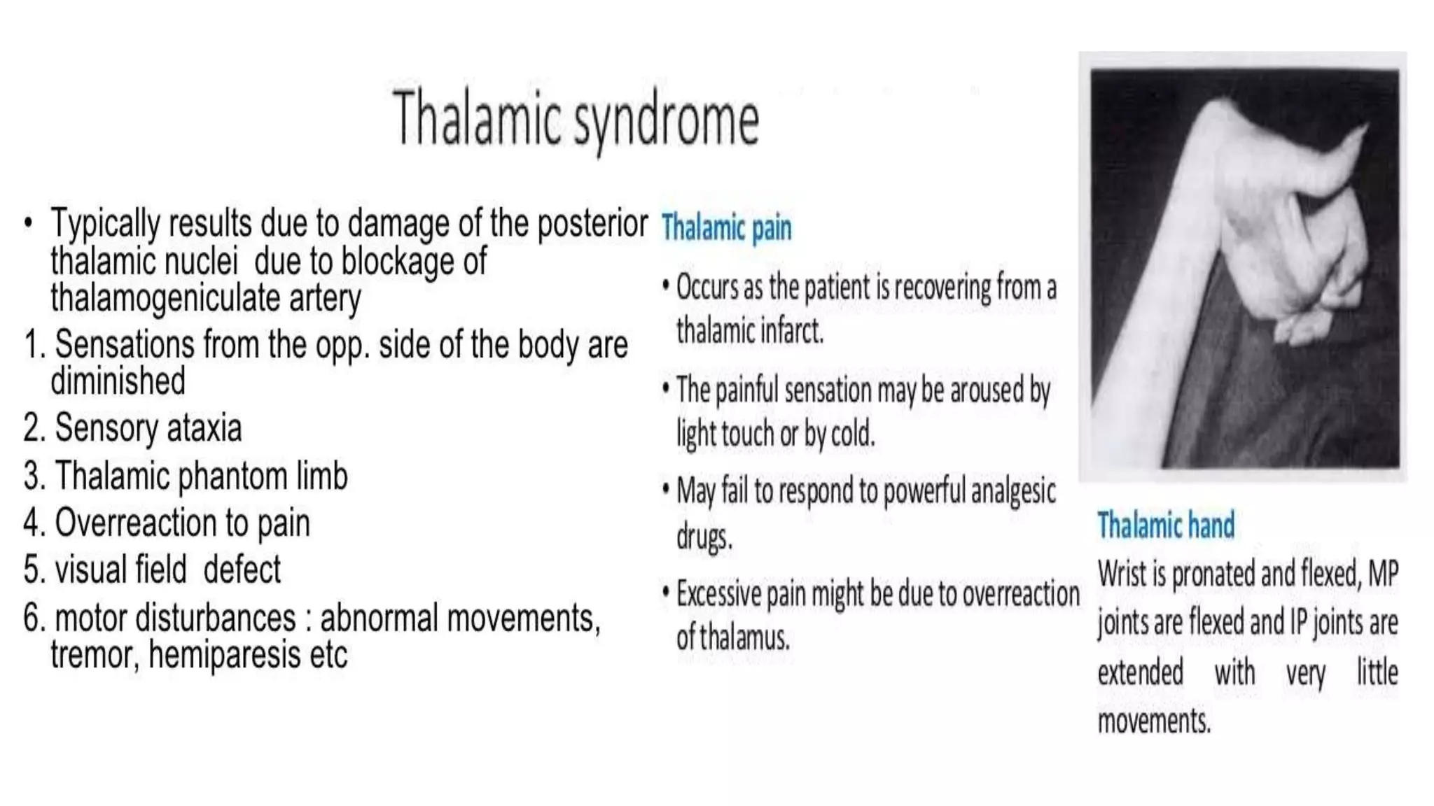 Thalamic syndrome | PPTX