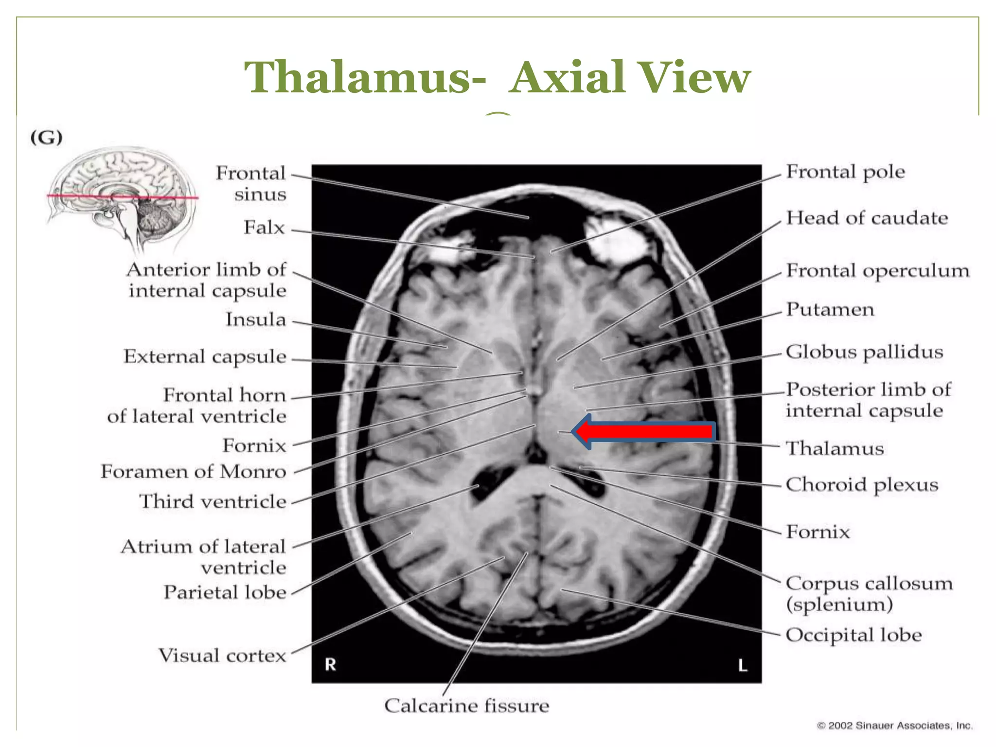 Thalamus | PPTX