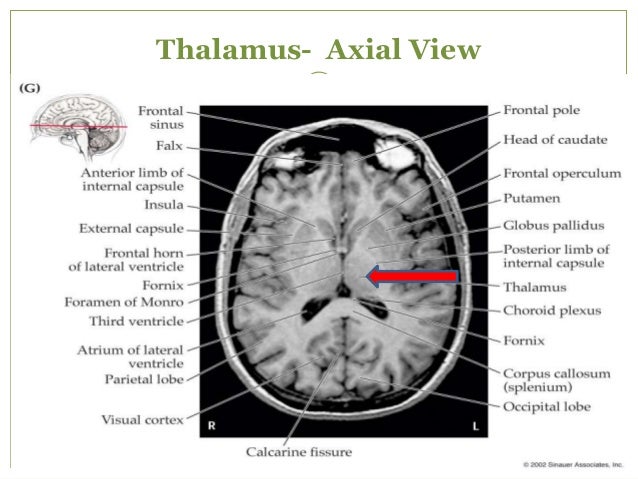 Thalamus