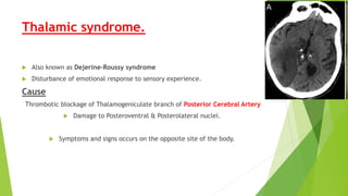 Thalamus-Anatomy,Physiology,Applied aspects | PPTX