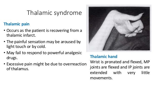 Antomy of Thalamus and hypothalamus