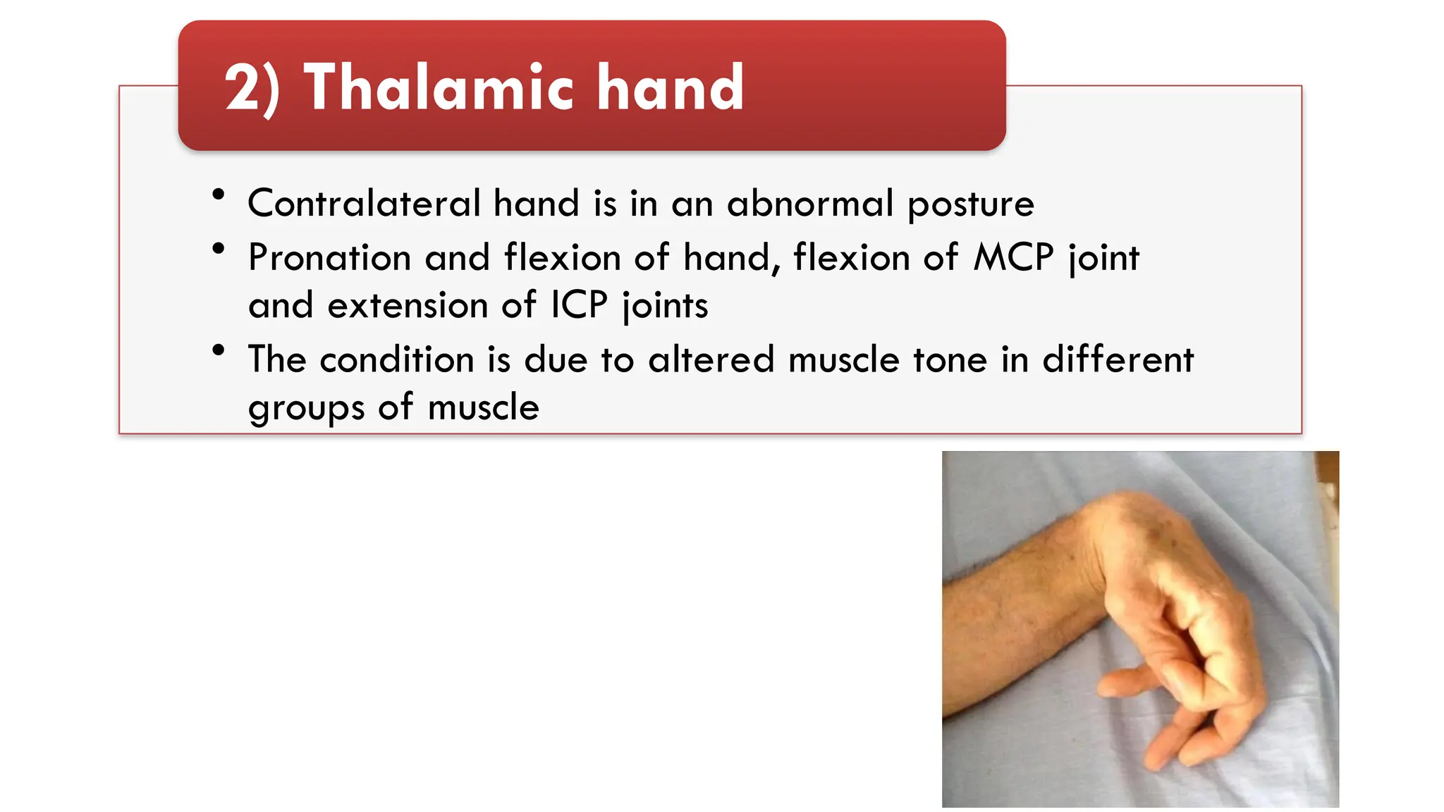 THALAMUS & HYPOTHALAMUS TOPIC PRESENTATION | PPTX