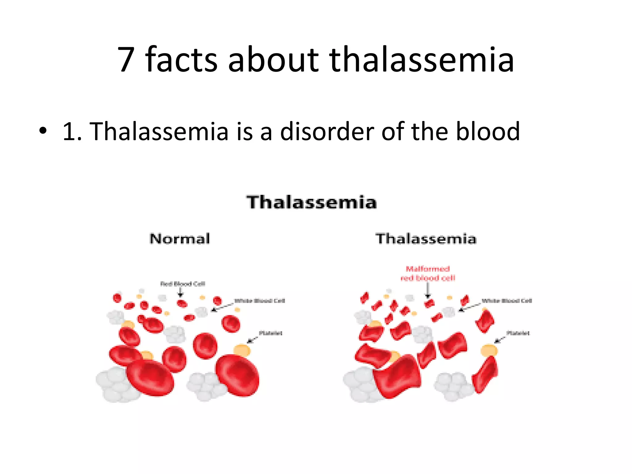 Thalasemia | PDF
