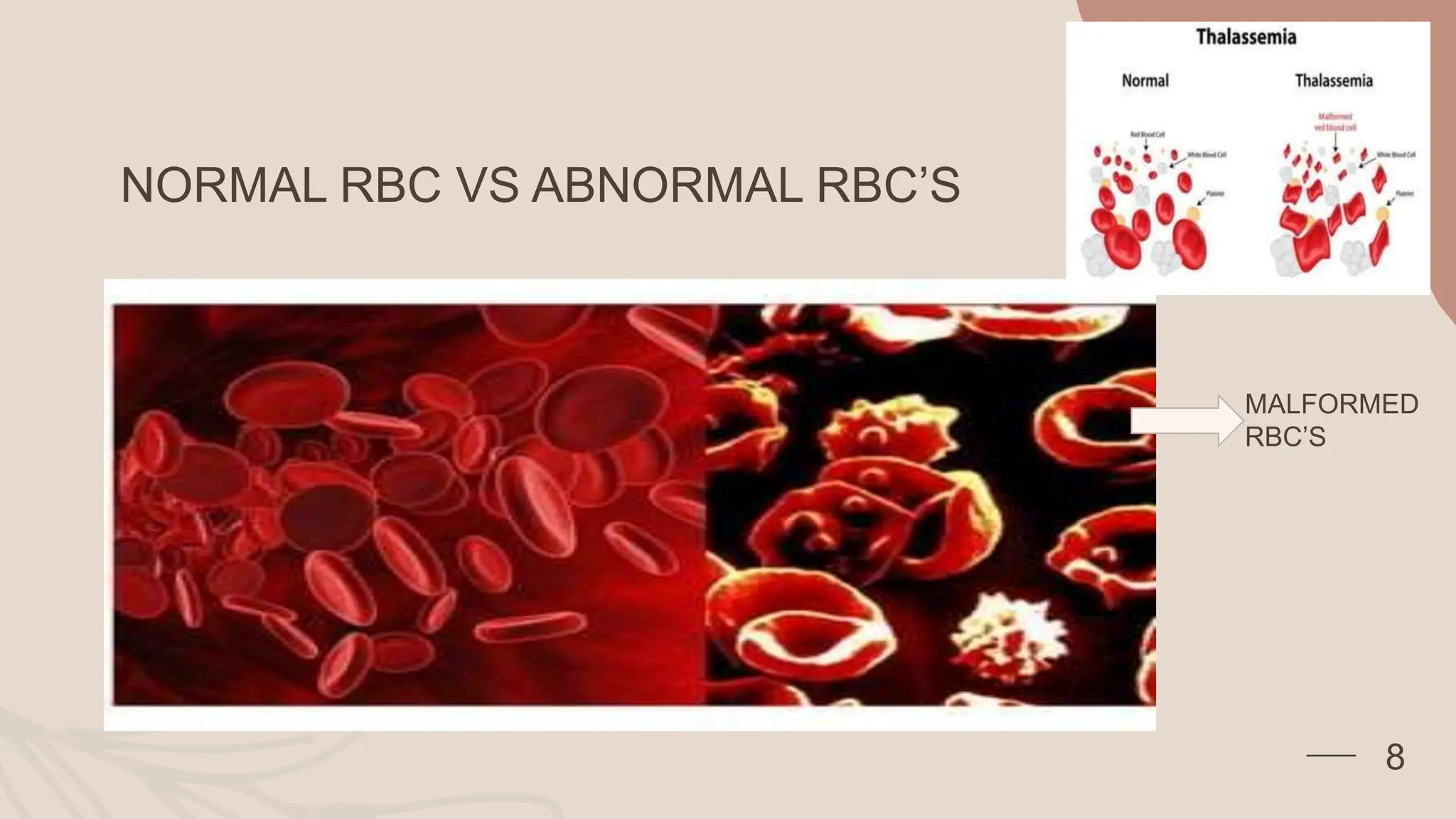 THALASEMIA definition and pathophysiologyd].pptx