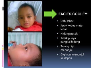 Thalasemia Case Report | PPT