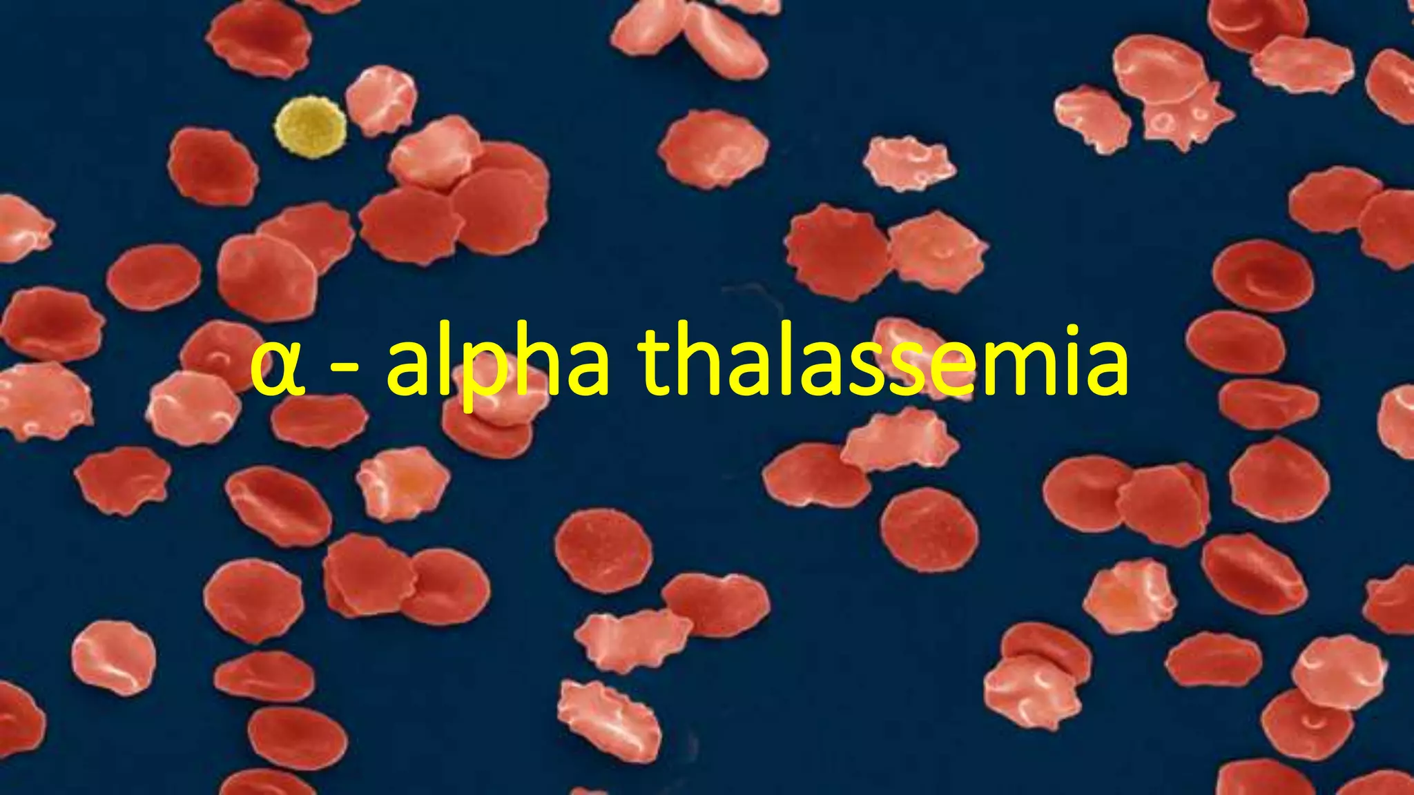 Thalassemia | PPTX