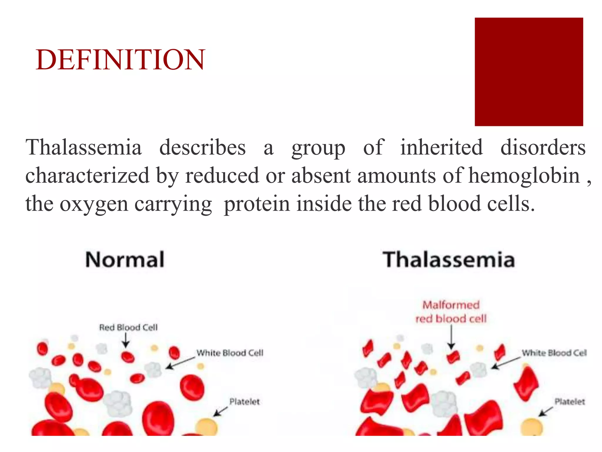 Thalassemia | PPTX