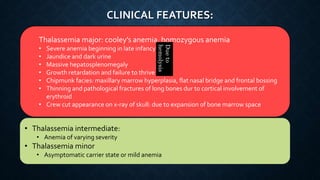 Thalassemia.ppt