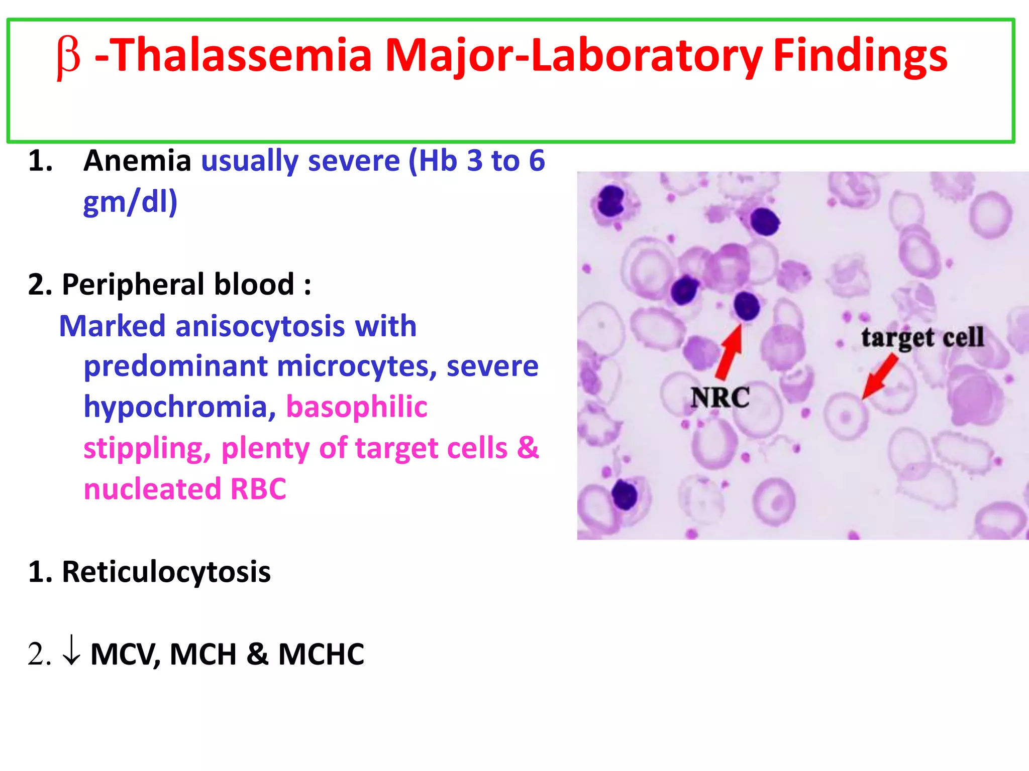 THALASSEMIA.pptx