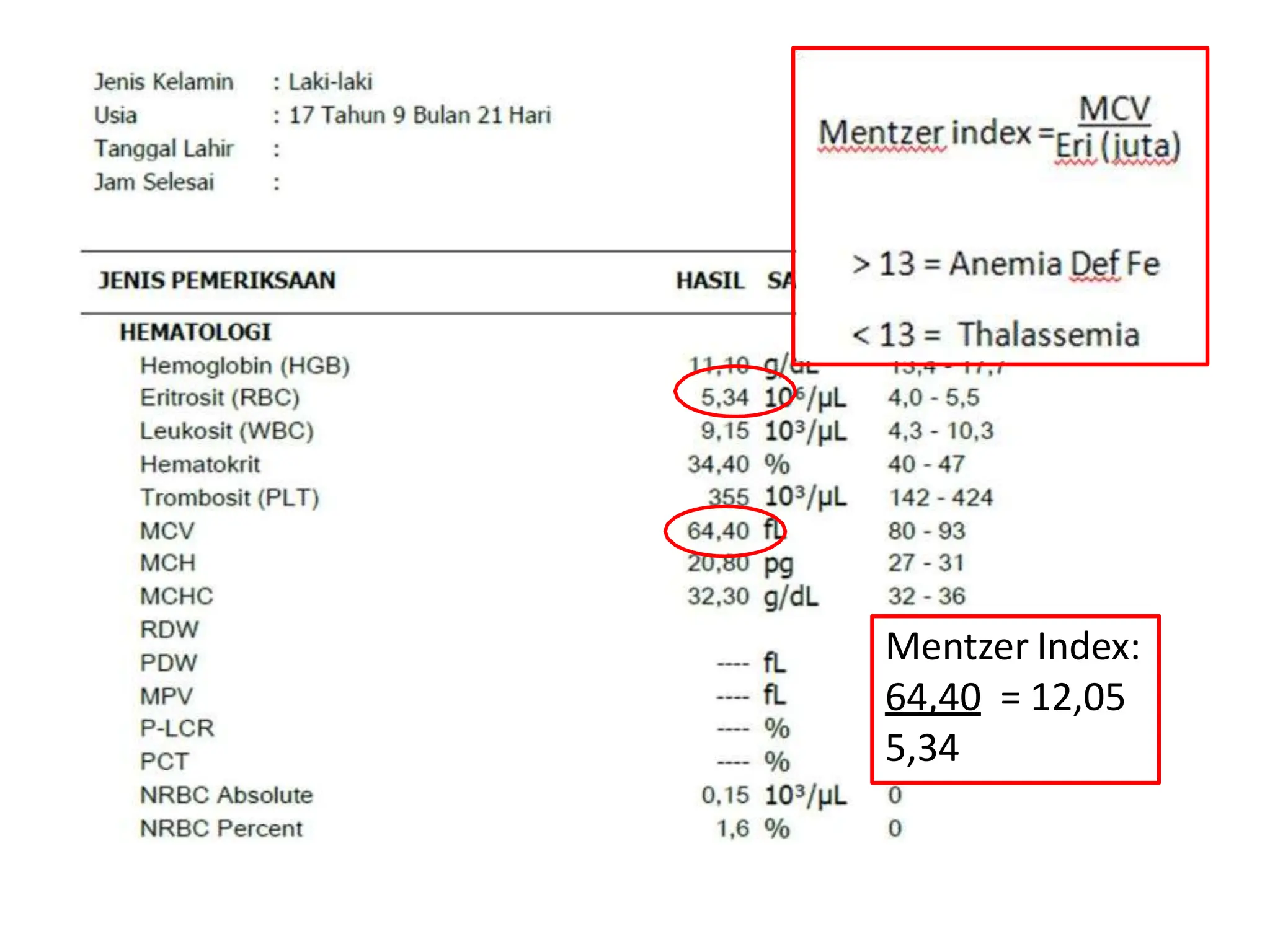 Thalassemia.pptx
