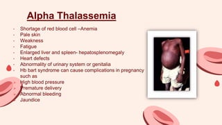 Thalassemia _082309.pptx