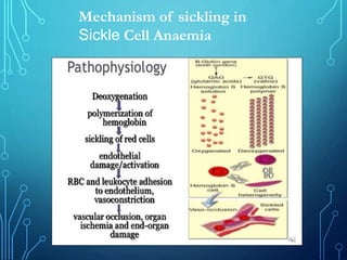 Thalassemia+%26+Sickle+Cell+++Anaemia%5B90%5D.ppt