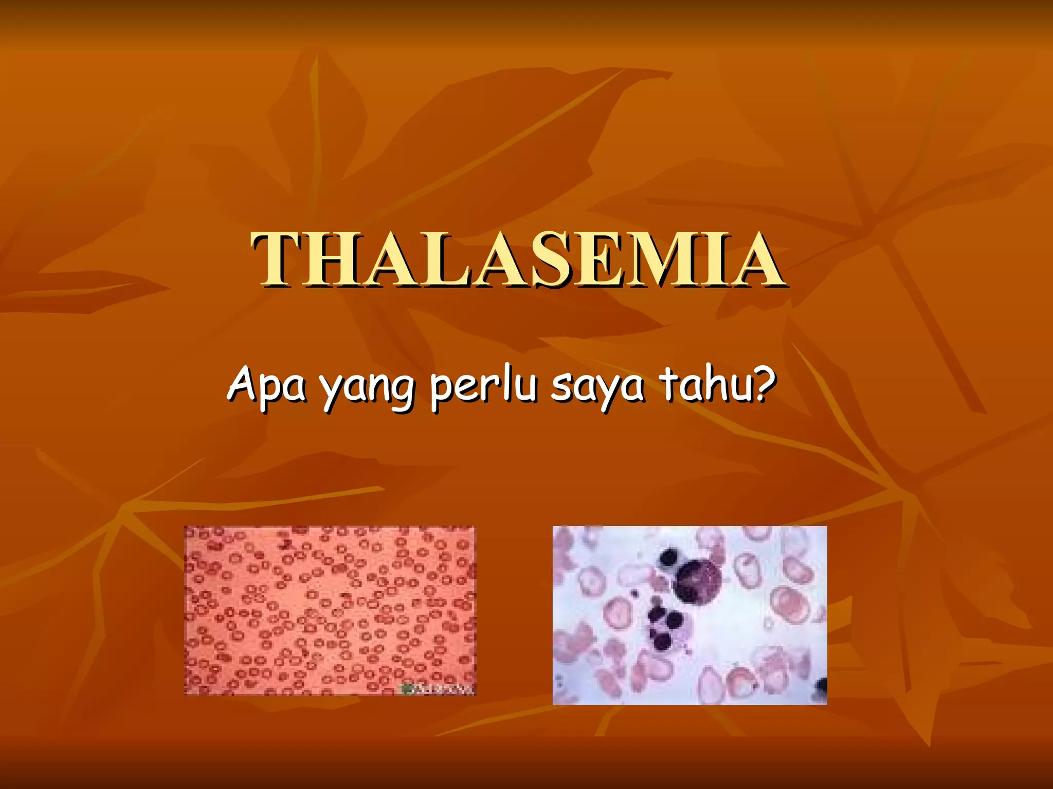 Thalassemia | PPT