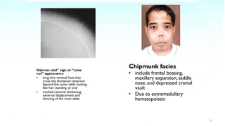 Thalassemia in OBGYN (July 2021) | PDF