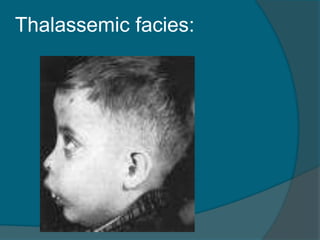 Thalassemia major minor & other subtypes Soumaditya | PPTX | Blood ...