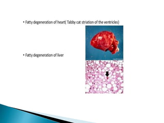 Thallium toxicity | PPTX