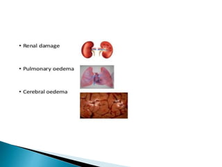 Thallium toxicity | PPTX