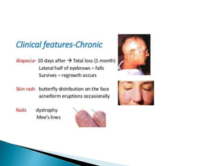 Thallium toxicity | PPT | Free Download