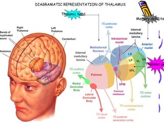 Thalmic stroke | PPT
