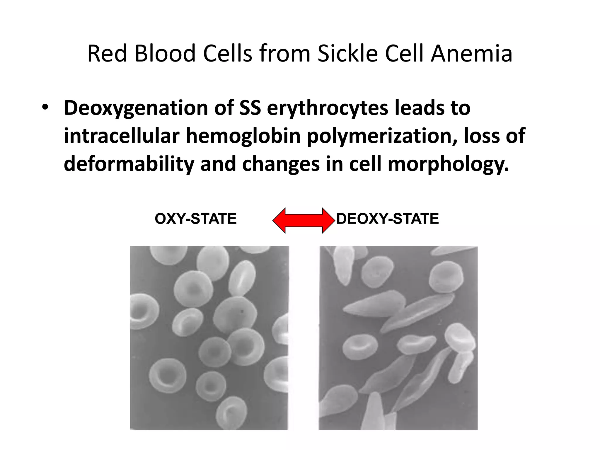 thalassemia and sickle cell disease | PPT