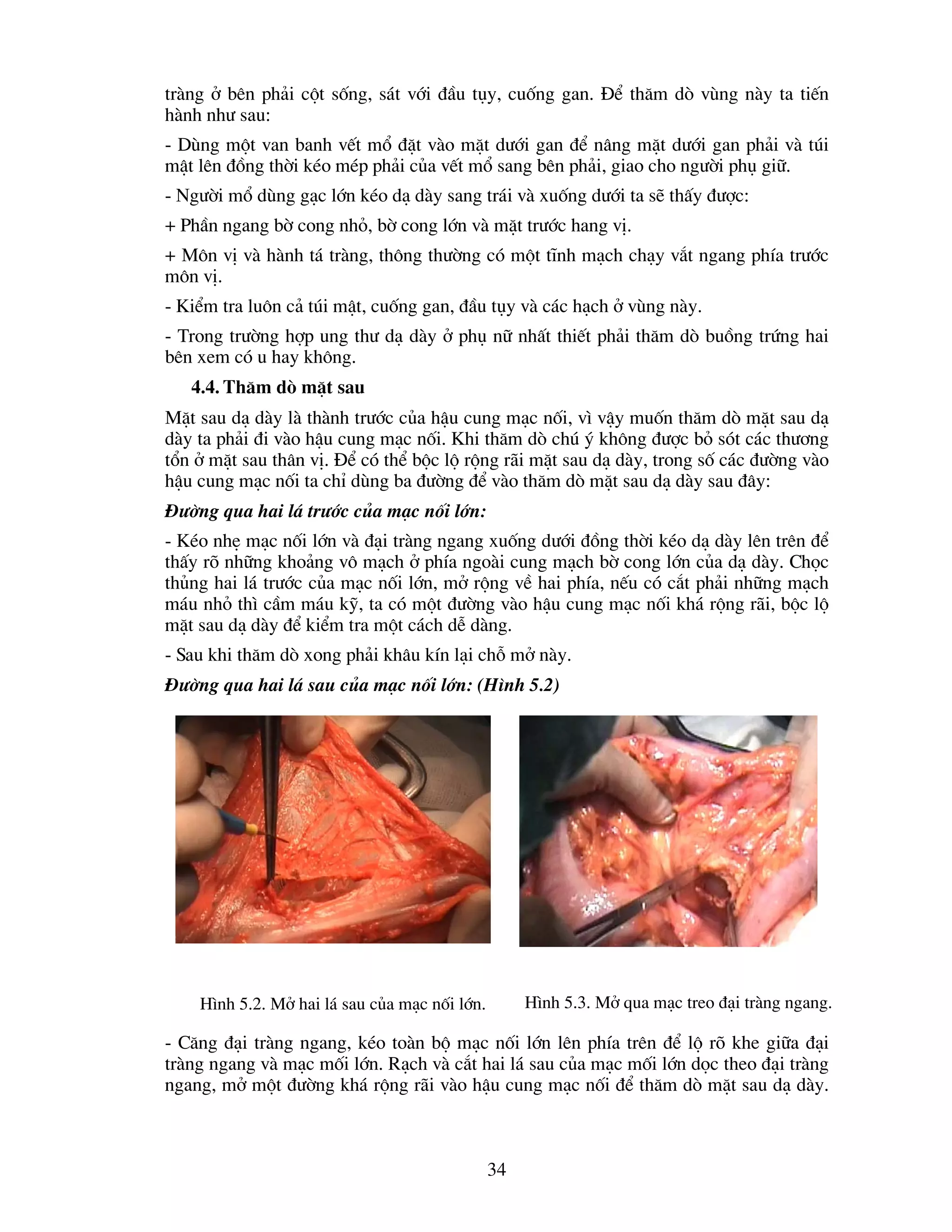 Tham Do O Bung | PPT