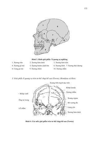 Than kinh cot song | PDF