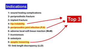 Total Hip Arthroplasty ( THA ) Revision | PDF