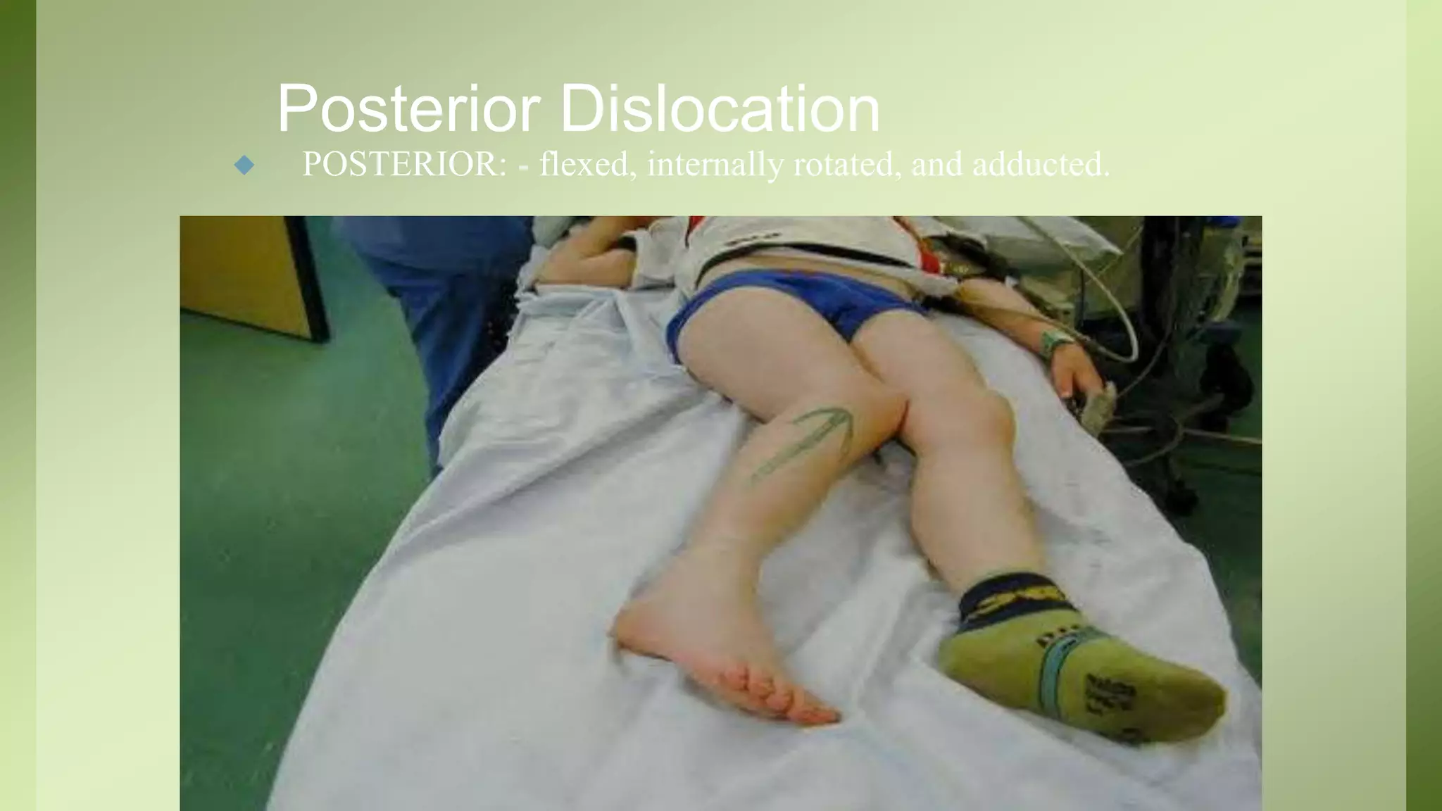 Tharinee anterior-hip-dislocation | PPTX