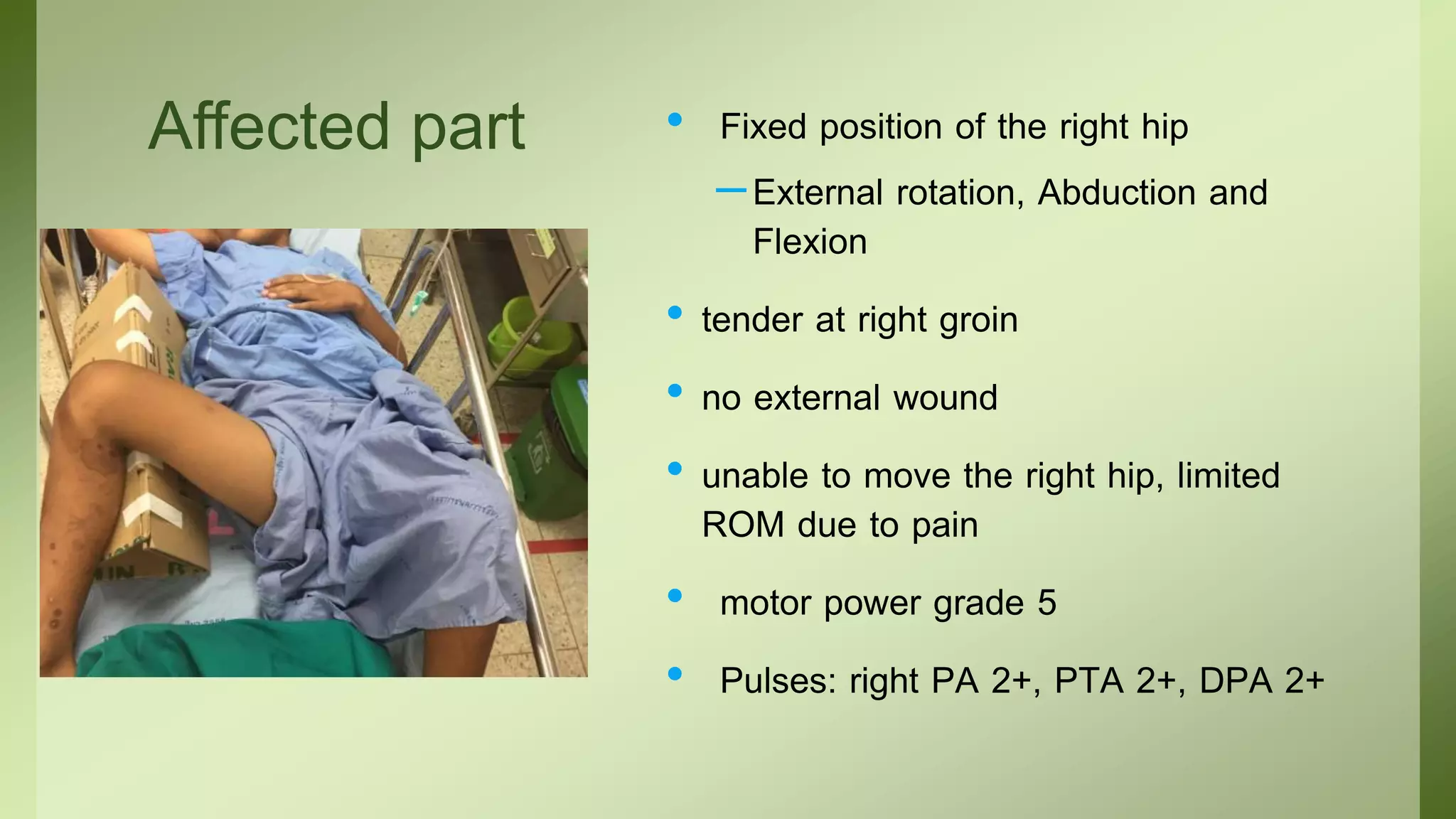 Tharinee anterior-hip-dislocation | PPTX