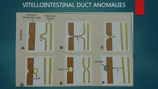 anatomy and physiology of small intestine | PPTX