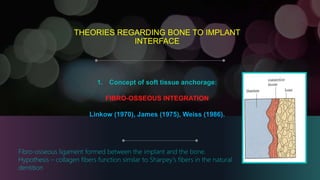 Osseointegration | PPTX