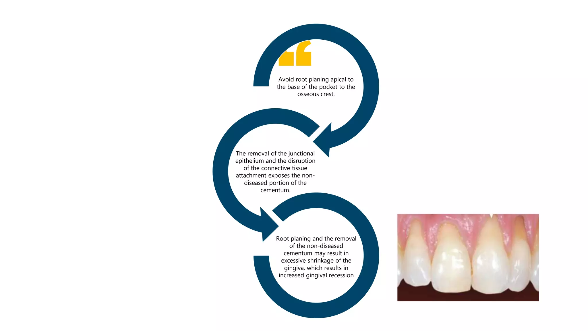 Gingival surgical techniques/Gingivectomy | PPTX