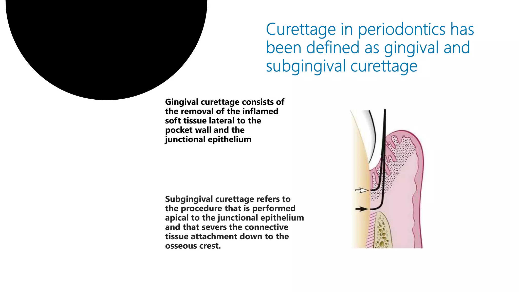 Gingival surgical techniques/Gingivectomy | PPTX