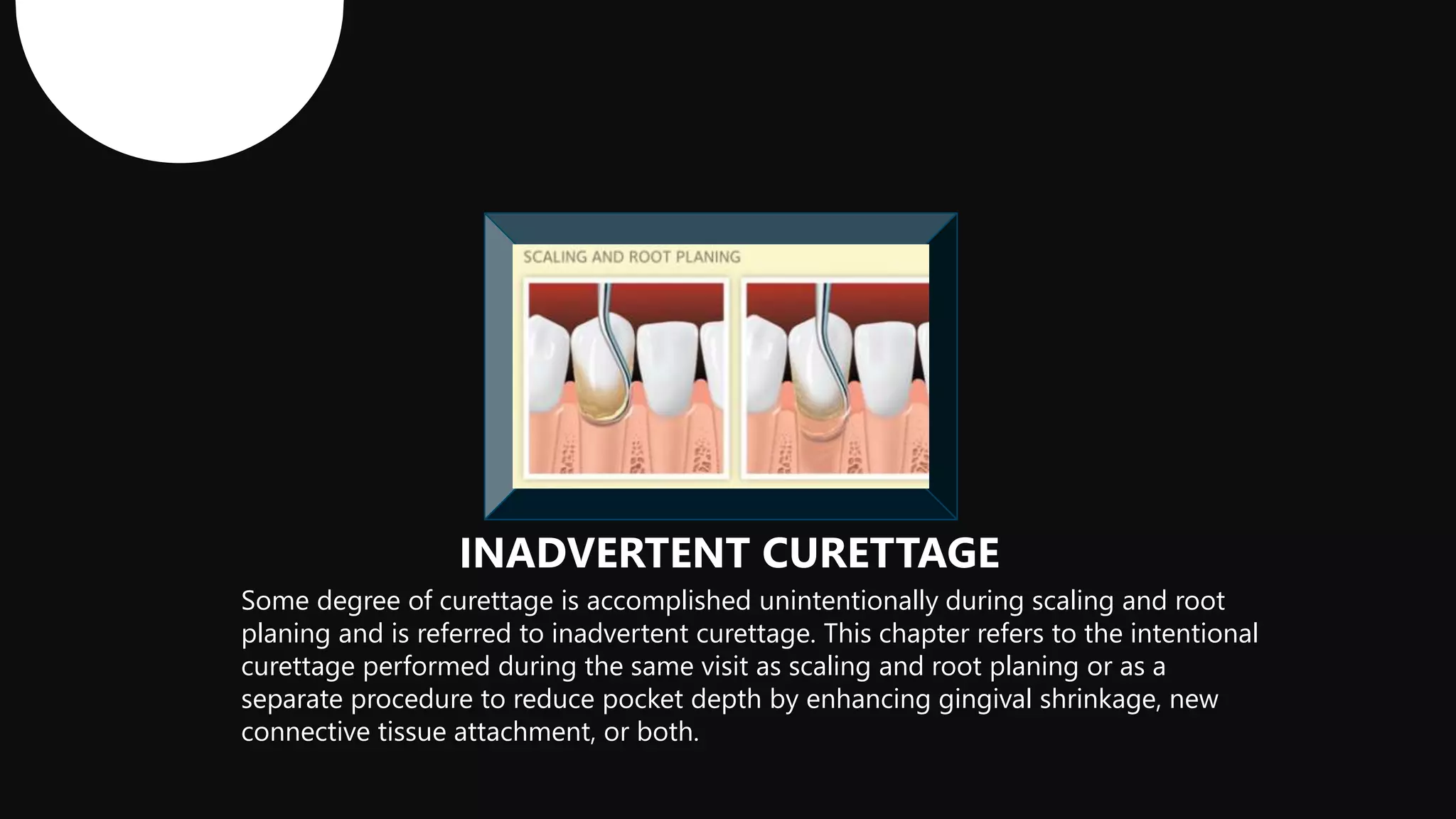 Gingival surgical techniques/Gingivectomy | PPTX