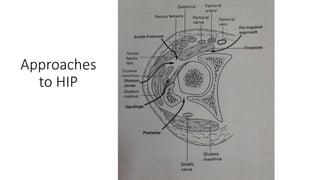 Tha surgical approaches and principles no video | PPTX