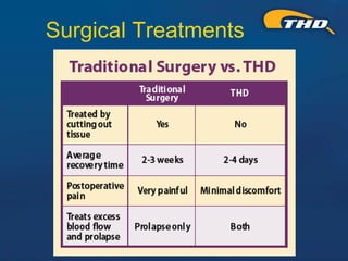 THD Procedure for Hemorrhoids: A Kinder, Gentler Approach - Presented ...