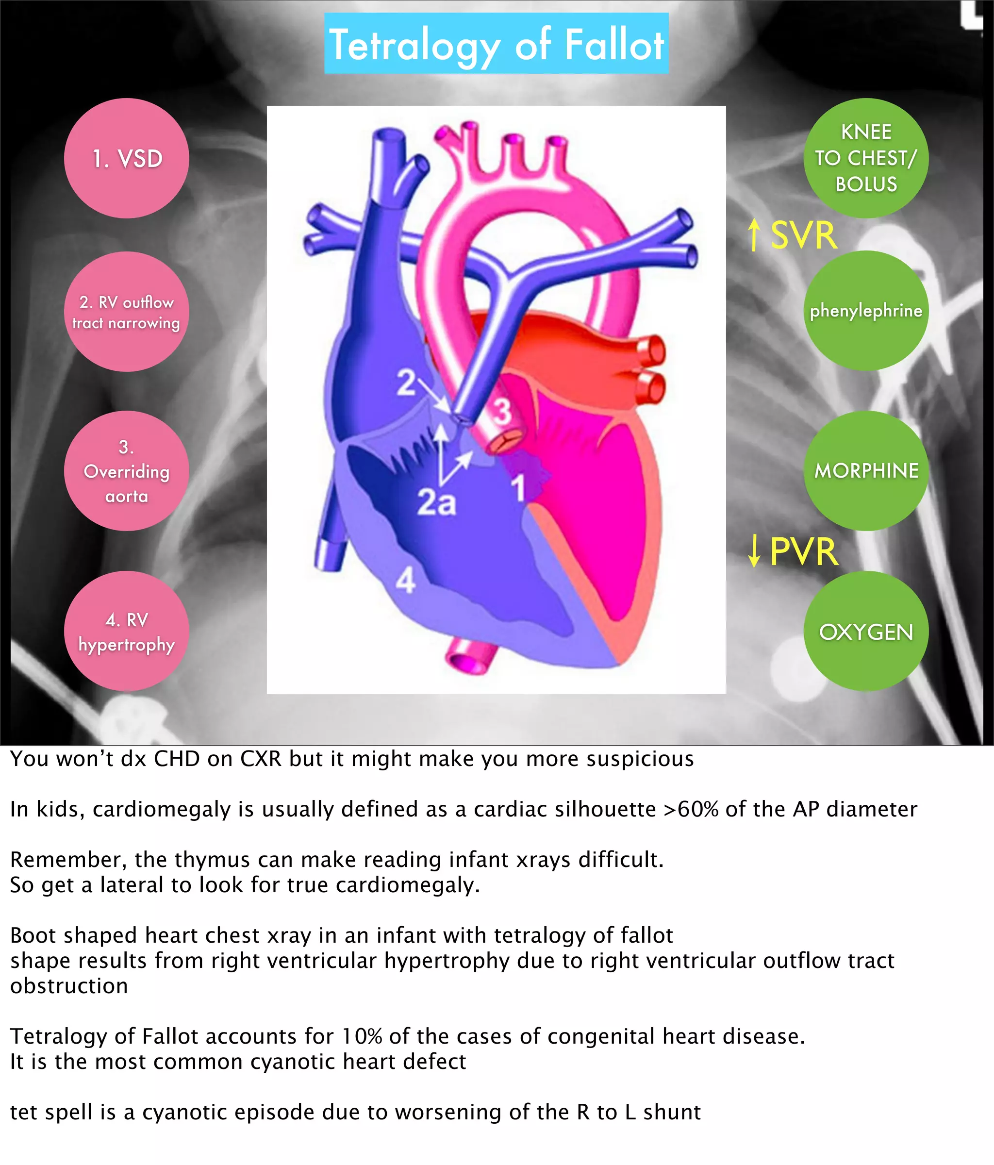 The Crashing Cardiac Baby | PDF