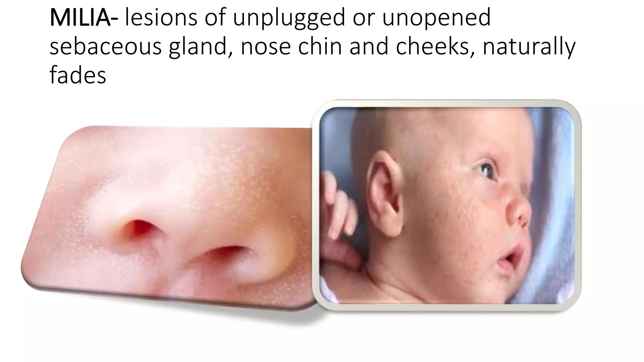 THE-APPEARANCE-OF-A-NEWBORN-ppt_(1).pptx