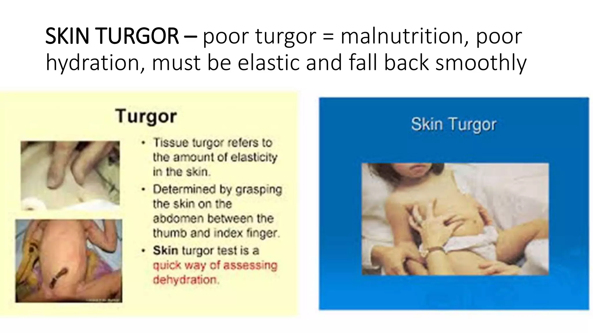 THE-APPEARANCE-OF-A-NEWBORN-ppt_(1).pptx