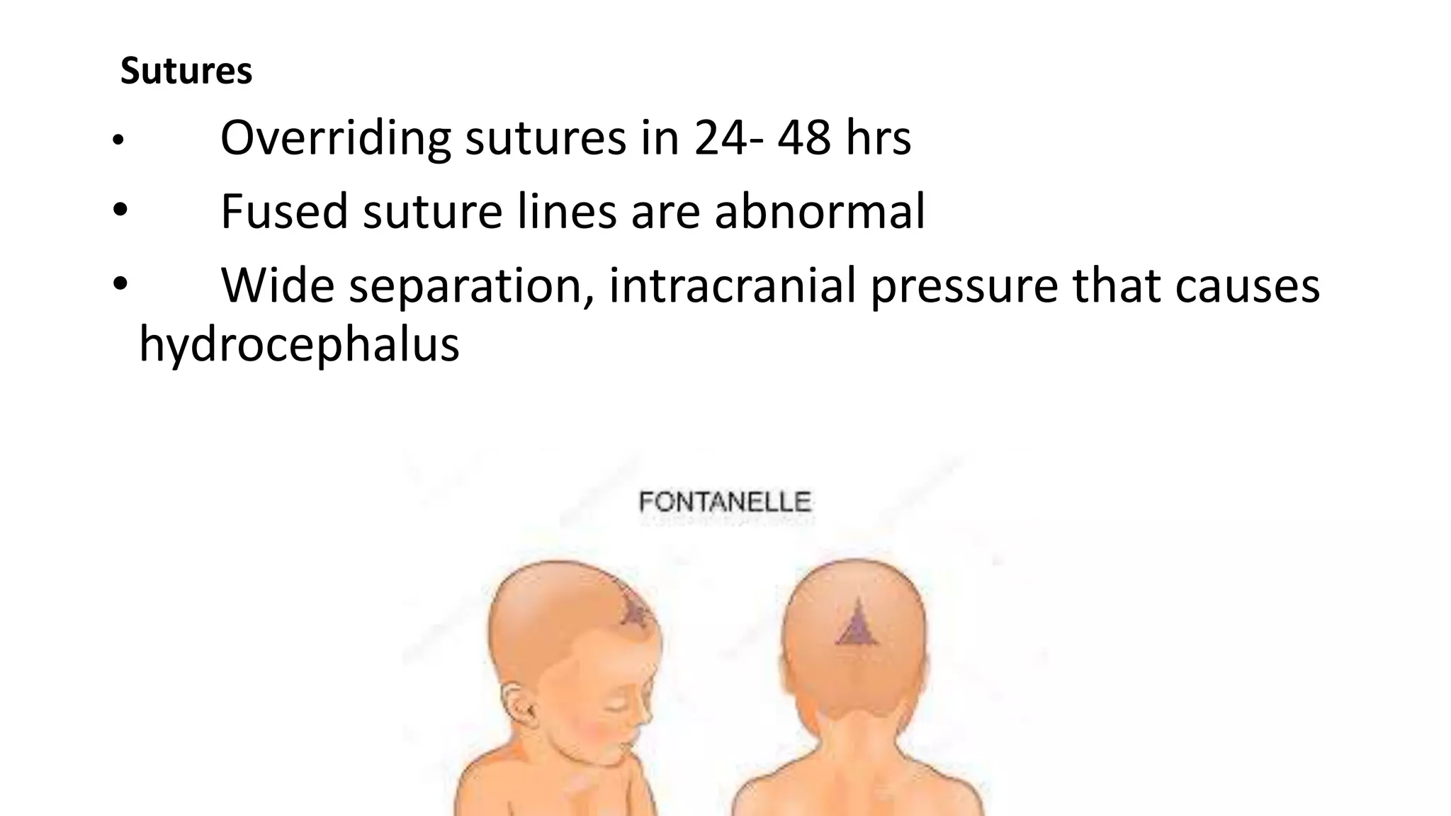 THE-APPEARANCE-OF-A-NEWBORN-ppt_(1).pptx