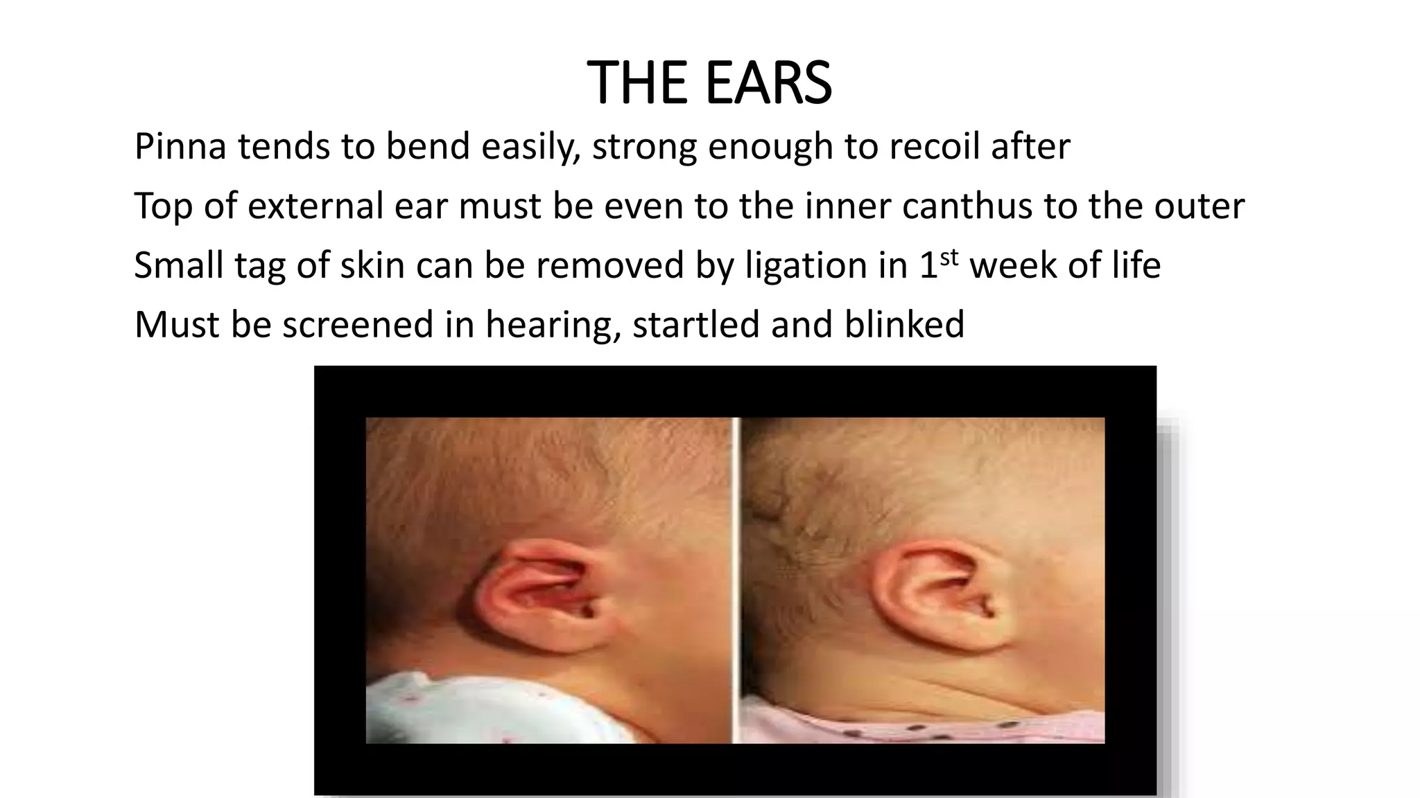 THE-APPEARANCE-OF-A-NEWBORN-ppt_(1).pptx