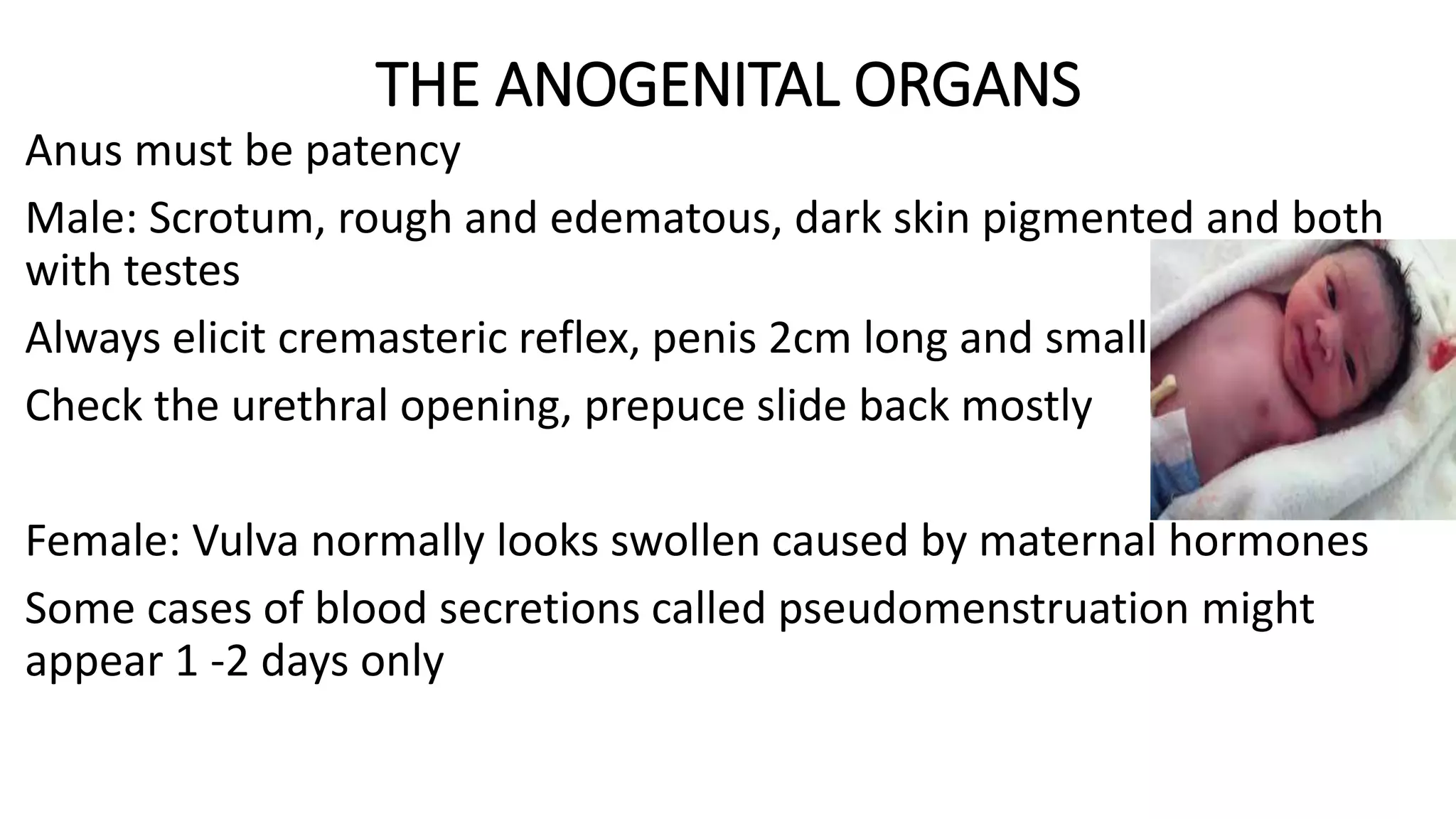 THE-APPEARANCE-OF-A-NEWBORN-ppt_(1).pptx