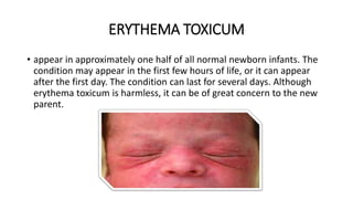 THE-APPEARANCE-OF-A-NEWBORN-ppt_(1).pptx