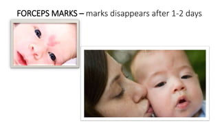 THE-APPEARANCE-OF-A-NEWBORN-ppt_(1).pptx
