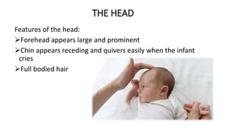 THE-APPEARANCE-OF-A-NEWBORN-ppt_(1).pptx