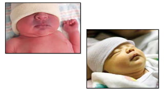 THE-APPEARANCE-OF-A-NEWBORN-ppt_(1).pptx