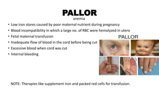 THE-APPEARANCE-OF-A-NEWBORN-ppt_(1).pptx