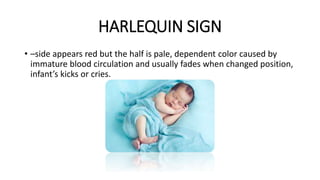 THE-APPEARANCE-OF-A-NEWBORN-ppt_(1).pptx