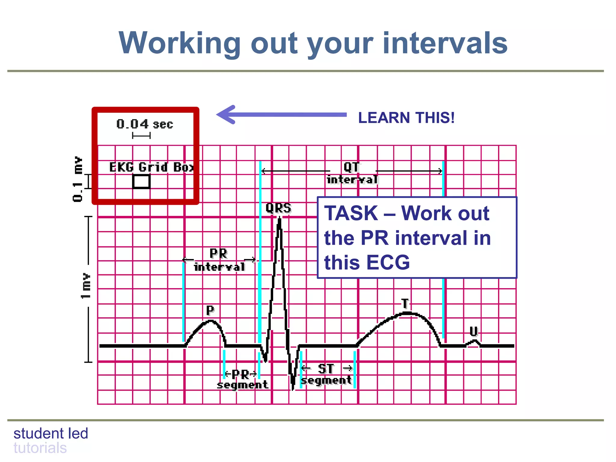 The Basics of ECG Interpretation | PPTX